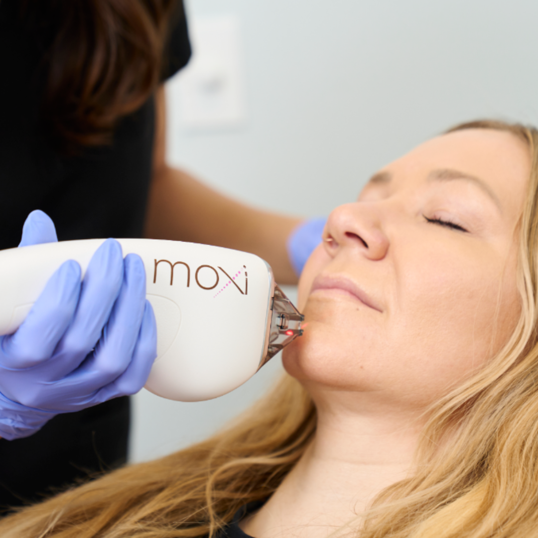 Sciton Moxi Laser Treatment - Best of Atlanta Winner 2025 | ELLEMES ...