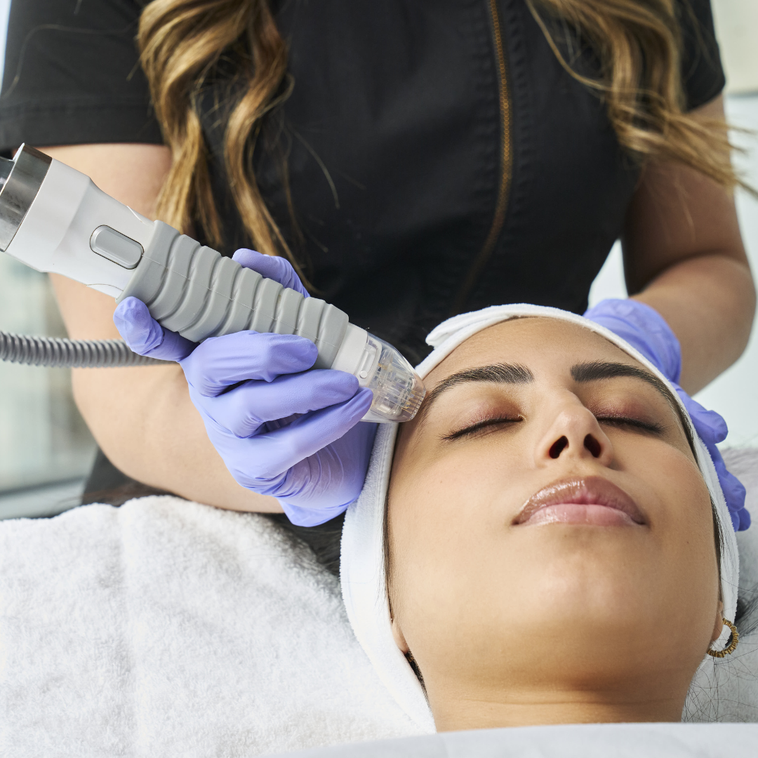 Best Vivace® RF Microneedling Atlanta & Sandy Springs, GA | May 2026